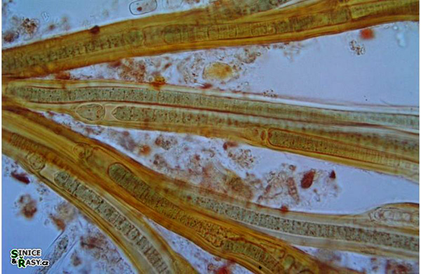 Phycokey - Dichothrix images